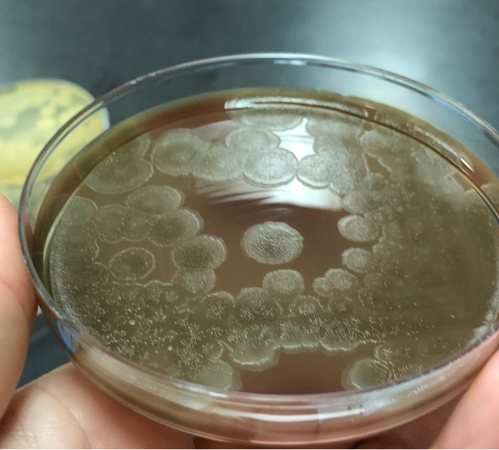 Solved Hi I’m trying to figure out which bacteria is this: | Chegg.com