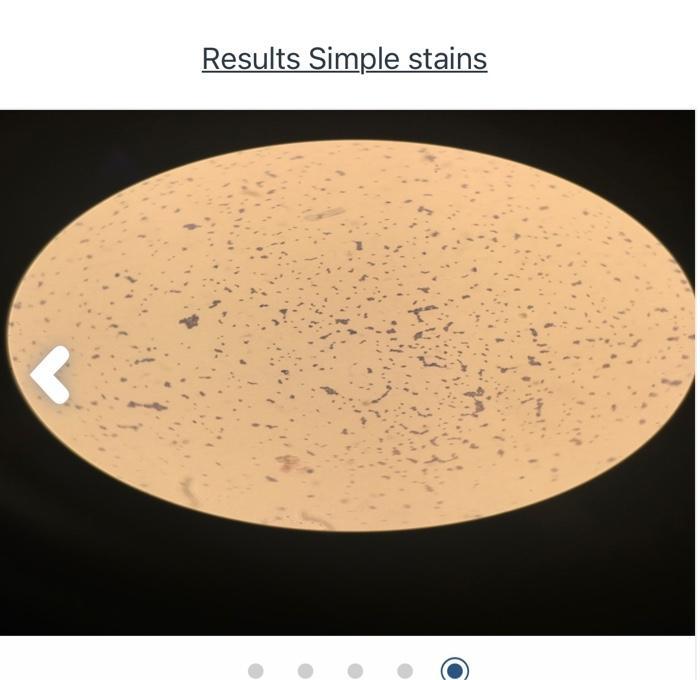 Solved Simple stain procedure: •Simple stain •Smears from | Chegg.com