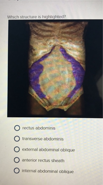 Solved Which structure is highlighted? O rectus abdominis | Chegg.com