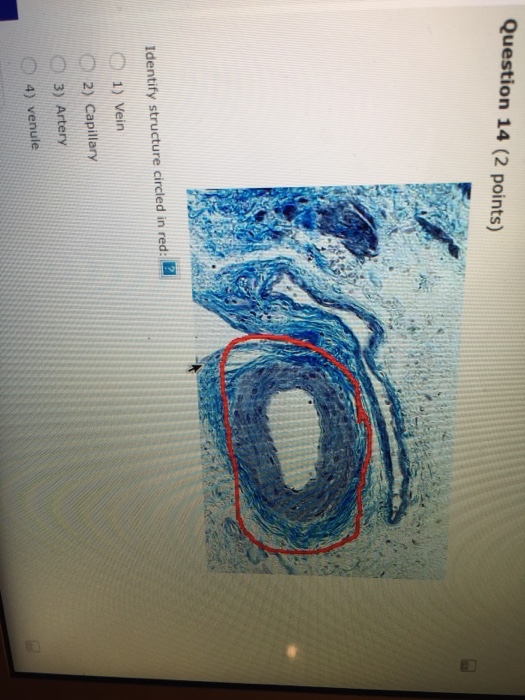 Solved Identify structure circled in red: 1) Vein 2) | Chegg.com