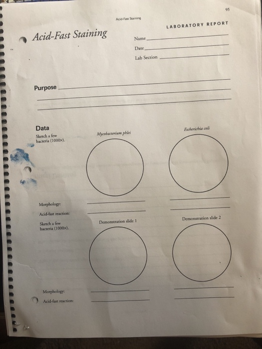 95 Acid-Fas Staining LABORATORY REPORT ?Acid-Fast | Chegg.com
