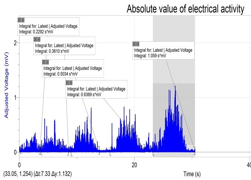 Solved Electromyography (EMG) Experiment Worksheet In | Chegg.com