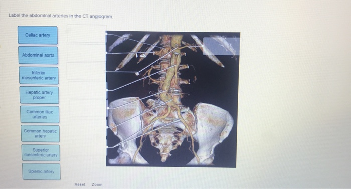 Solved Label the abdominal arteries in the CT angiogram. | Chegg.com