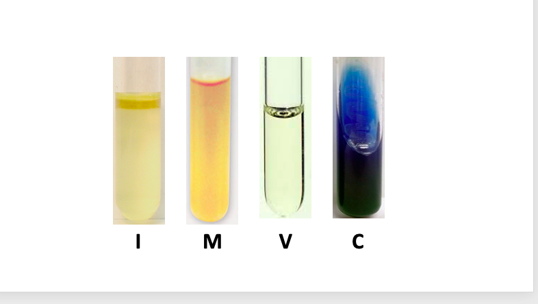 Solved Determine the results for the each IMVC? If it's | Chegg.com