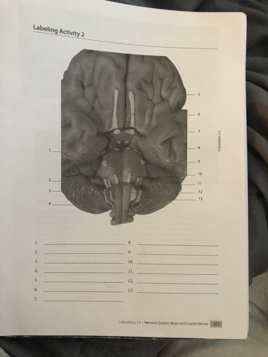 Solved Labeling Activity 2 10 12 10. 12. Laboratory 13 | Chegg.com