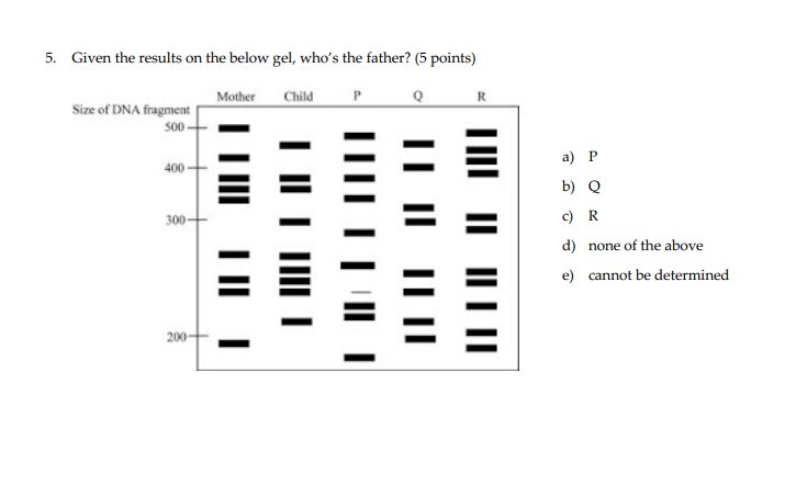 Solved 5 Given The Results On The Below Gel Whos The 