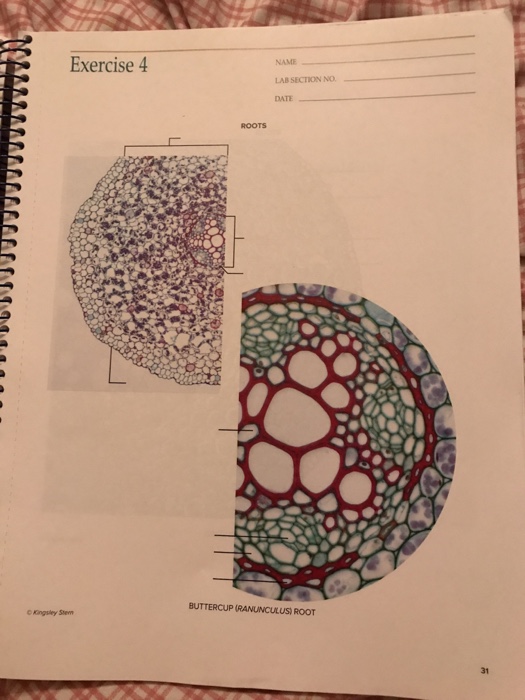 Solved ROSS SECTION OF A YOUNG PEA (PISUM SATIVUM) ROOT S | Chegg.com