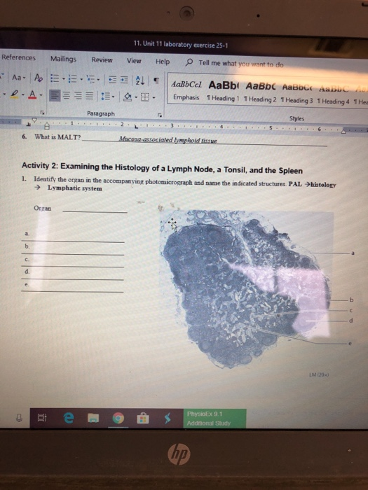 Solved 11. Unit 11 laboratory exercise 25-1 References | Chegg.com