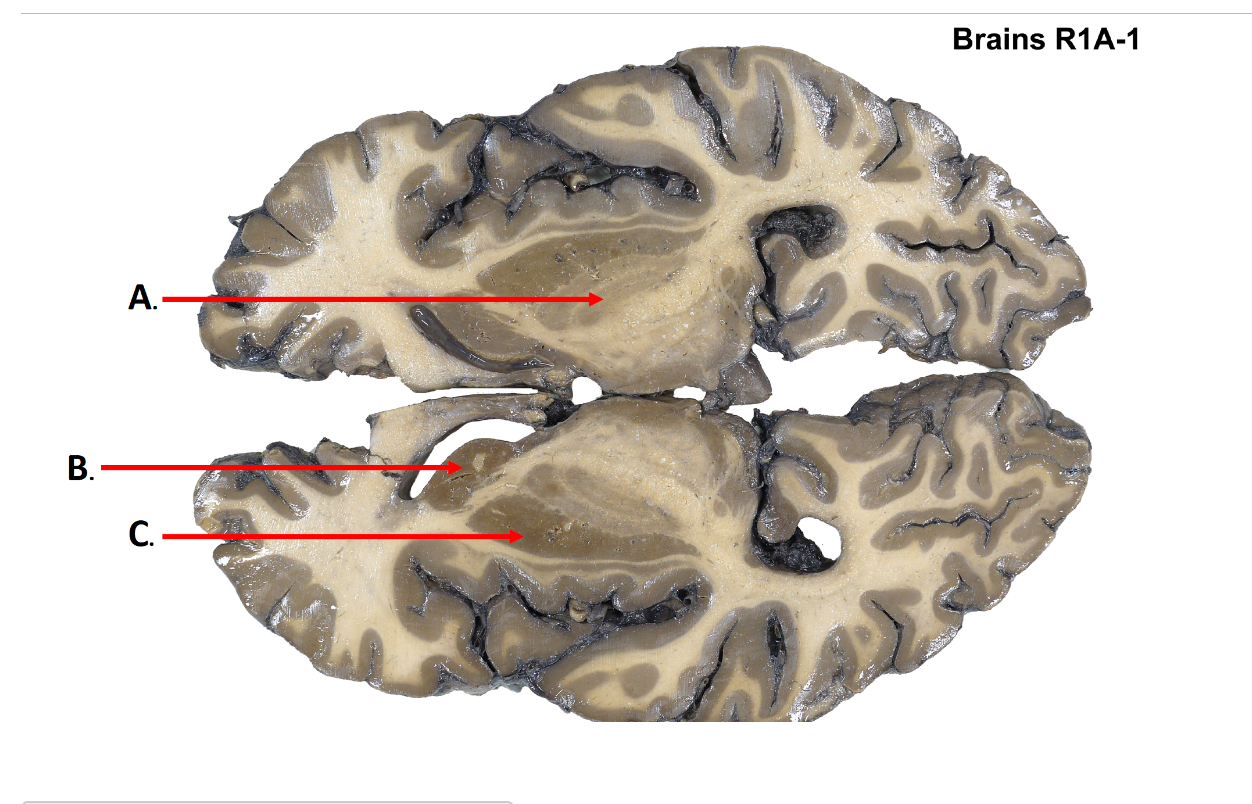 Identify the structures labelled A, B and C. | Chegg.com