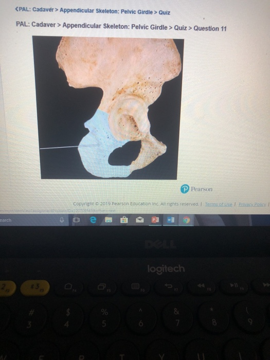 Solved: Cadaver> Appendicular Skeleton: Pelvic Girdle > Qu... | Chegg.com