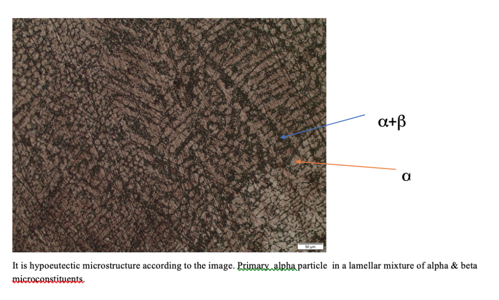 It is hypoeutectic microstructure according to the | Chegg.com