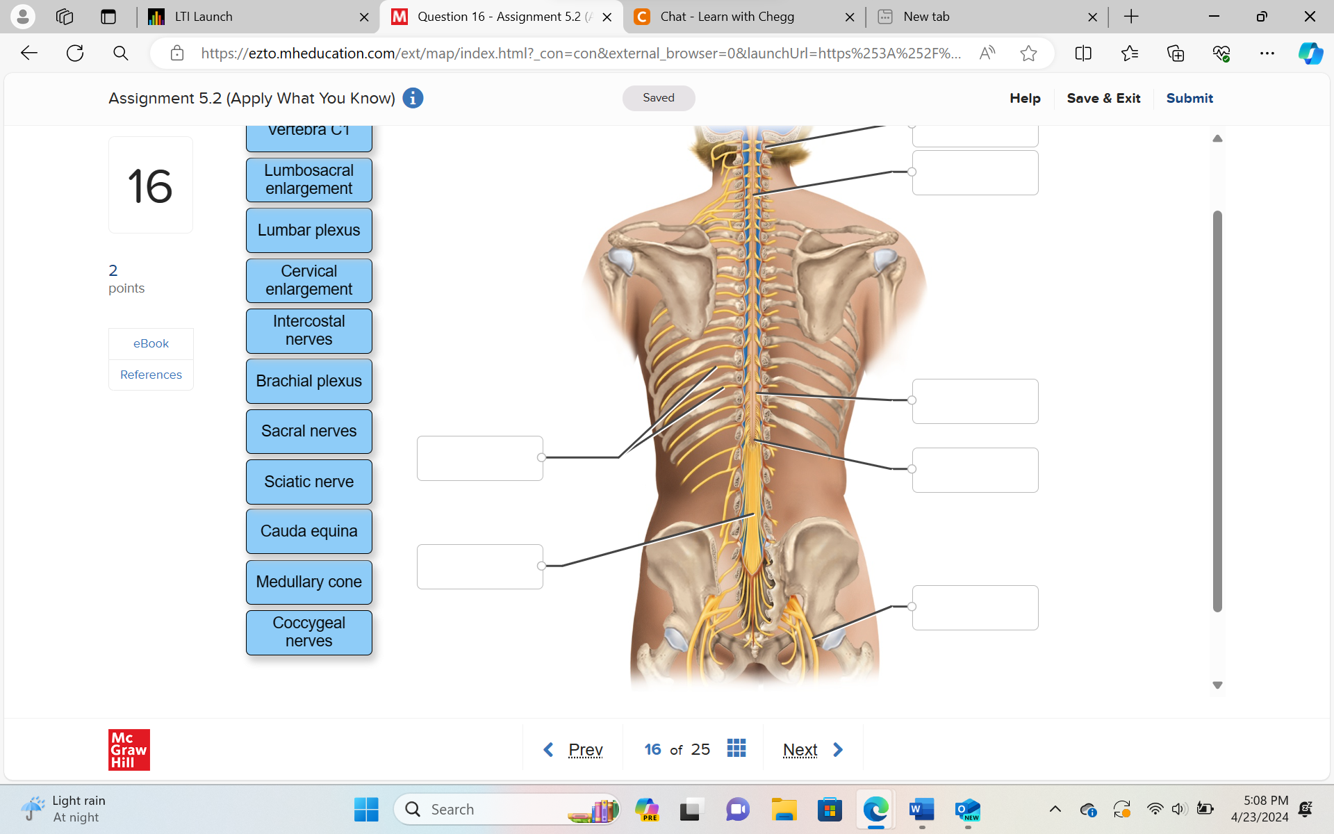 Solved Correctly identify and label the anatomical parts of | Chegg.com