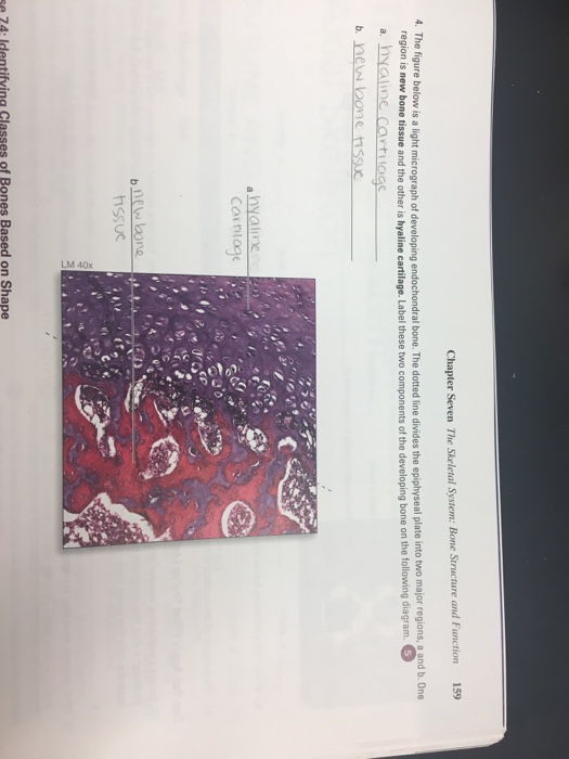 Solved 159 Chapter Seven The Skeletal System: Bone Structure | Chegg.com