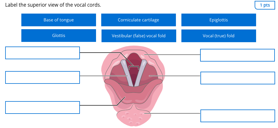 Solved Label the superior view of the vocal cords.Please | Chegg.com