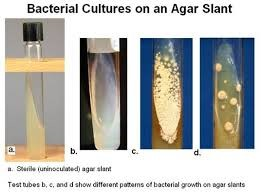 Solved These are the following growth of microorganisms in | Chegg.com