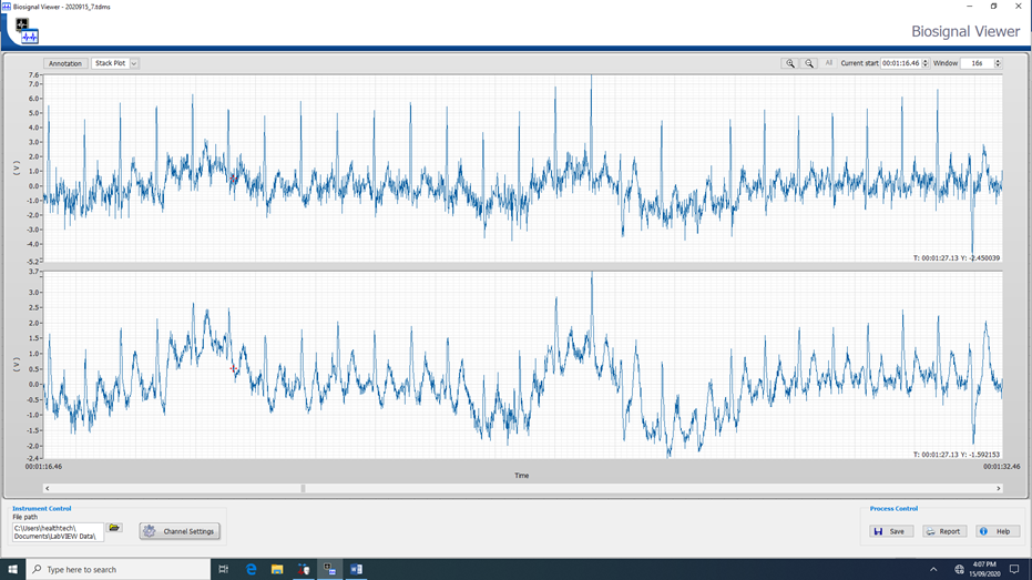 Solved Procedure National Instruments myDAQ is an relatively | Chegg.com