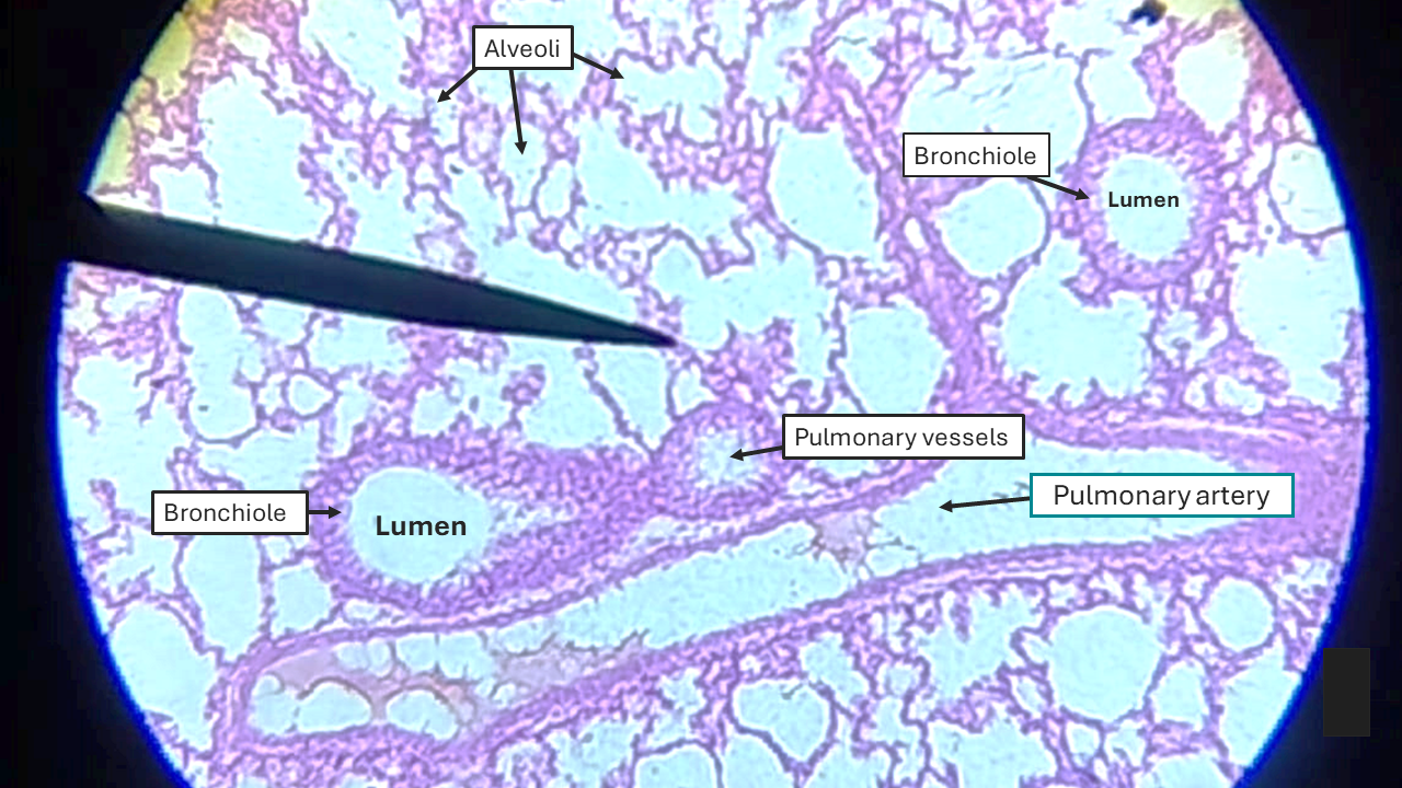 Solved Bronchiole Lumen Alveoli Bronchiole Pulmonary vessels | Chegg.com
