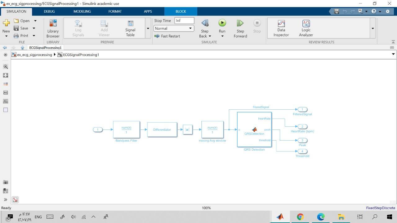 X ex_ecg_sigprocessing/ECGSignal Processing 1 - | Chegg.com
