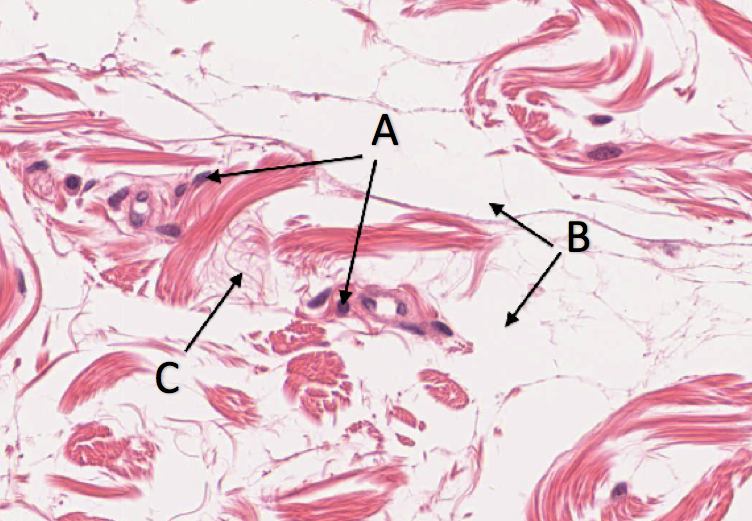 Solved SPECIFIC TISSUE TYPE: Loose Fibrous | Chegg.com