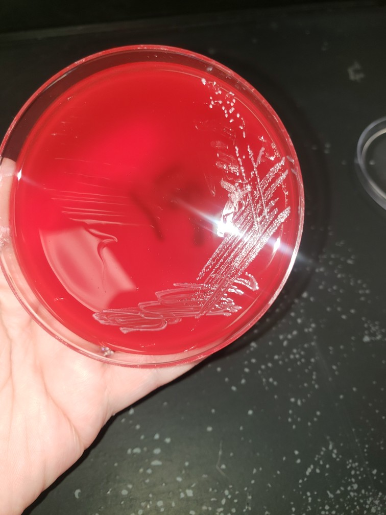 Solved what kind of staph is this? It is catalase positive | Chegg.com