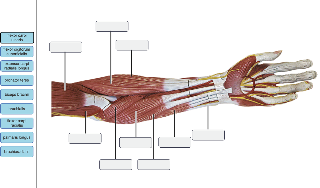 Solved flexor carpi ulnaris flexor digitorum superficialis | Chegg.com