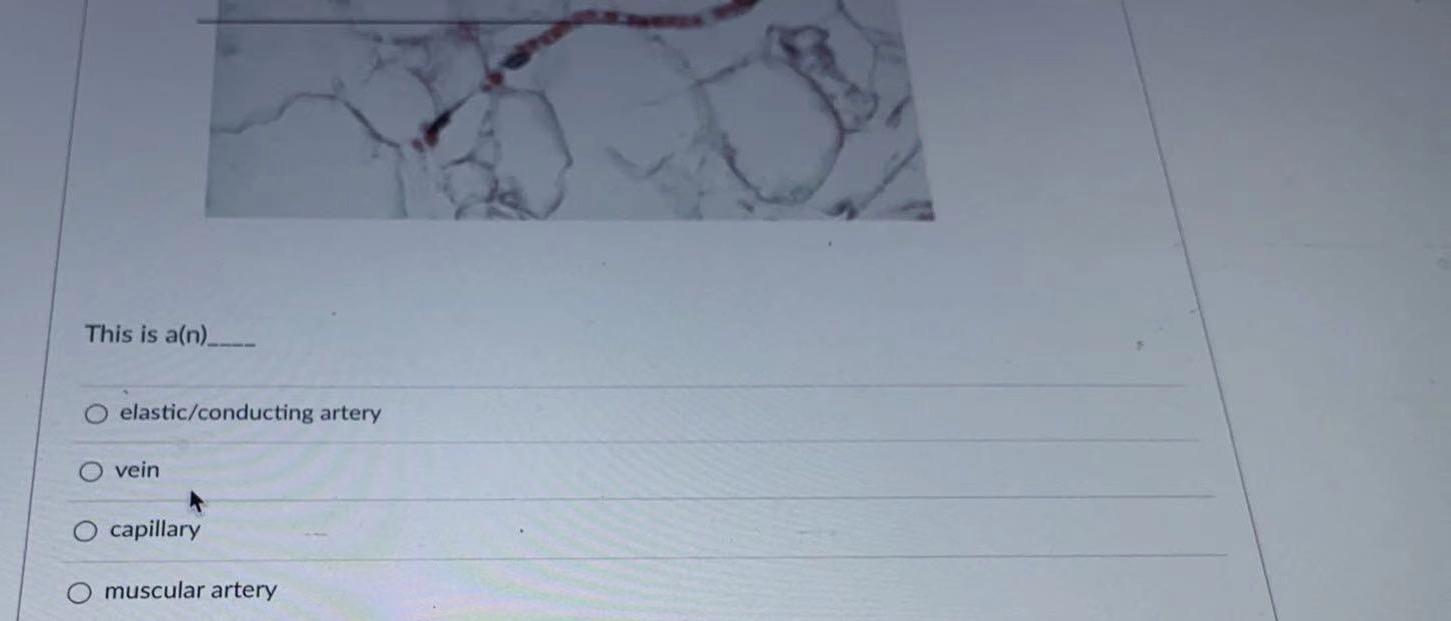 Solved Capillary in adipose tissue; longitudinal section | Chegg.com