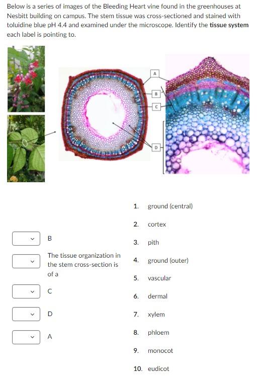 Solved Below is a series of images of the Bleeding Heart | Chegg.com