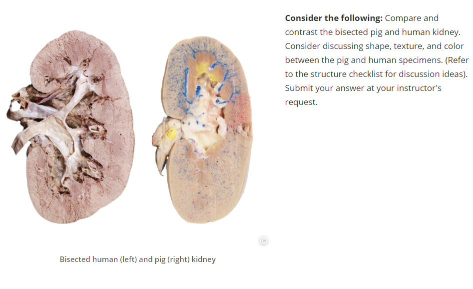 Solved Consider the following: Compare and contrast the | Chegg.com