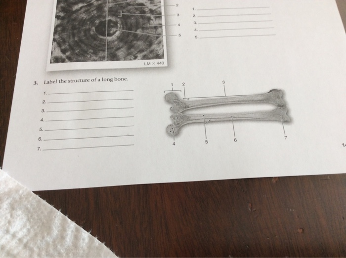 Solved 2 3 LM X 440 3 Label The Structure Of A Long Bone Chegg