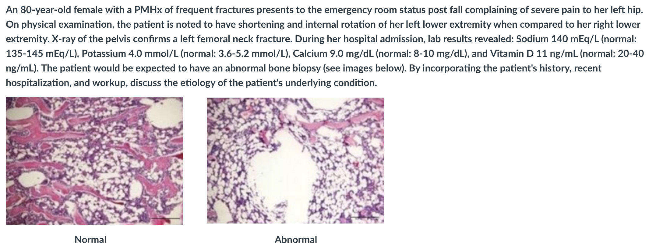 Solved An 80-year-old female with a PMHx of frequent | Chegg.com