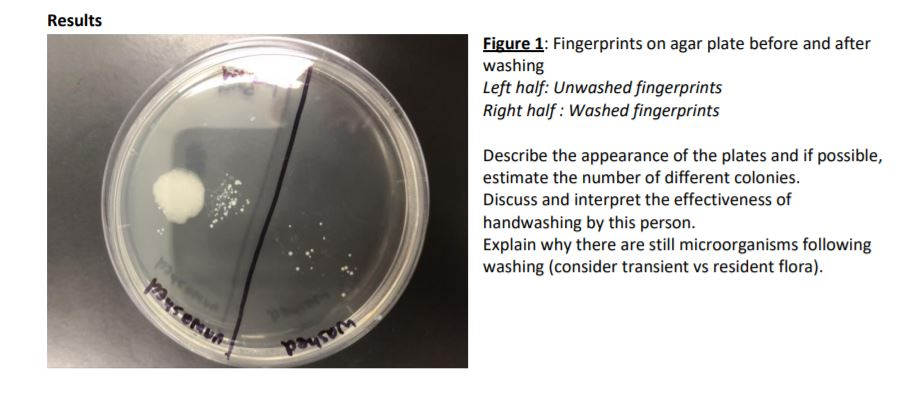 Solved Results Figure 1: Fingerprints on agar plate before | Chegg.com