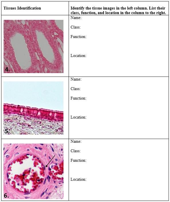 Solved \begin{tabular}{|l|l|} \hline Tissues Identification | Chegg.com