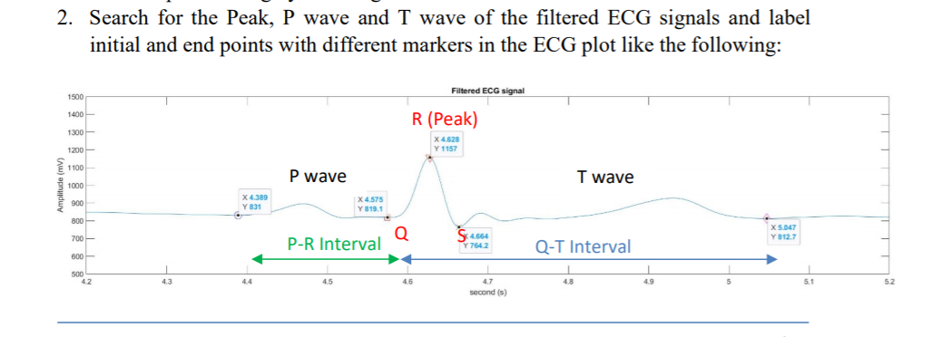 MATLAB ECG signal analyser. I cant provide the ecg | Chegg.com
