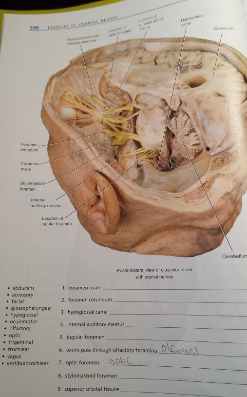 Olfactory Foramina Location