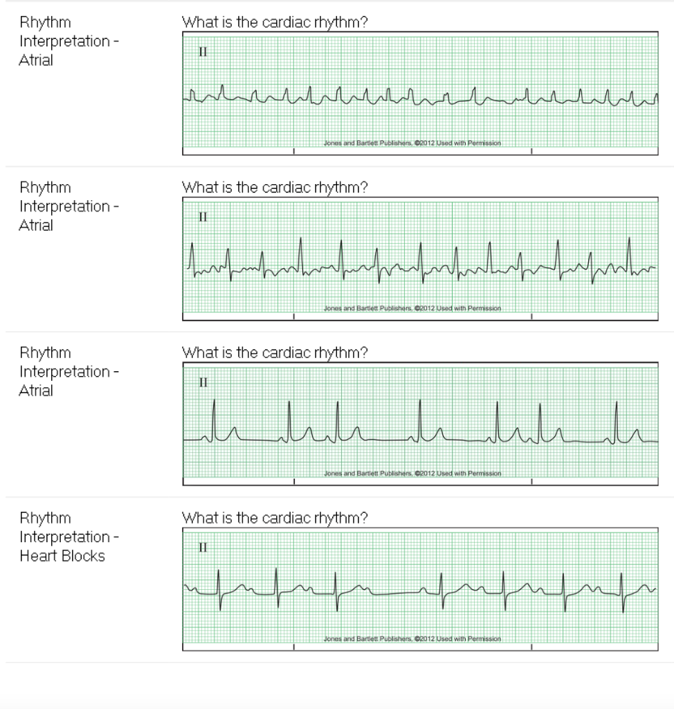 Subject Question F What is the cardiac rhythm? Rhythm | Chegg.com