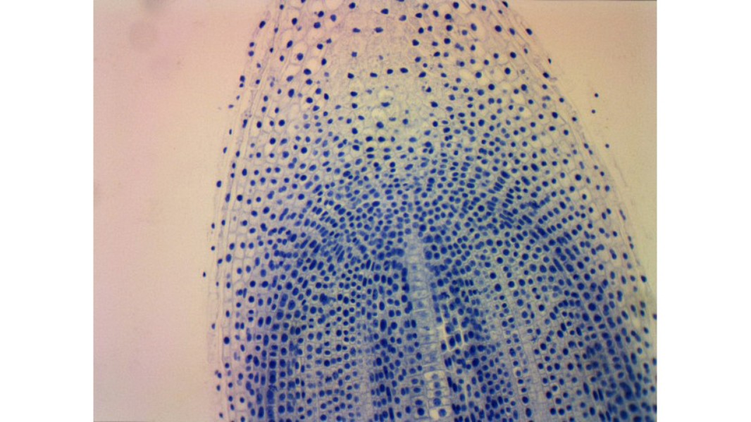 Solved Locate a cell undergoing the G2 phase of | Chegg.com