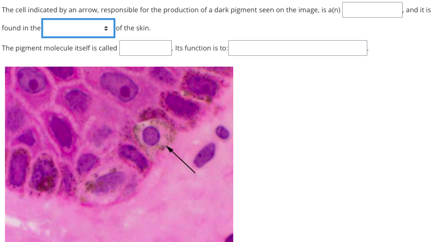 Solved muscle called arrector pili. The muscle is attached | Chegg.com