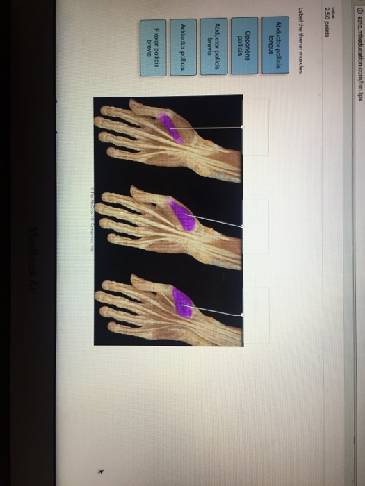 Label the thenar muscles. Abductor pollicis longus | Chegg.com