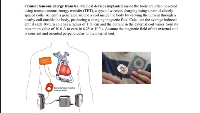 Solved Transcutaneous energy transfer. Medical devices | Chegg.com