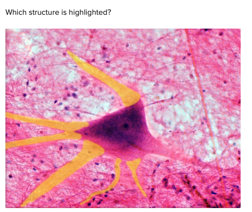 Solved Which structure is highlighted? | Chegg.com
