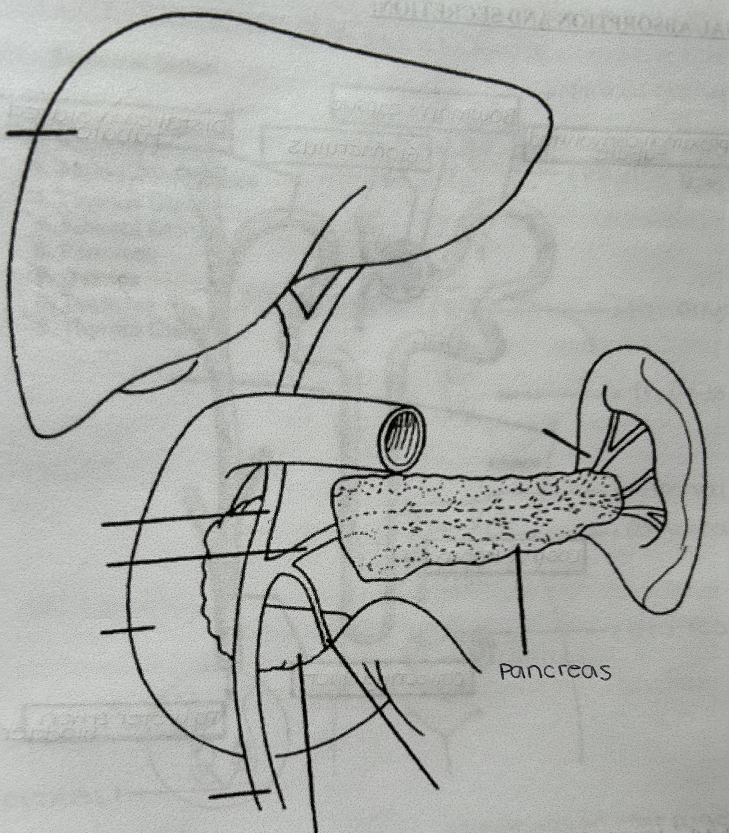 Solved Label the above Hepato-biliary system and state the | Chegg.com