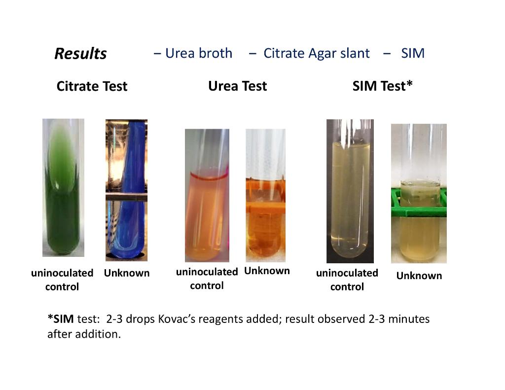 Solved E. Unknown Procedure – Stage 4 (25 points total) | Chegg.com