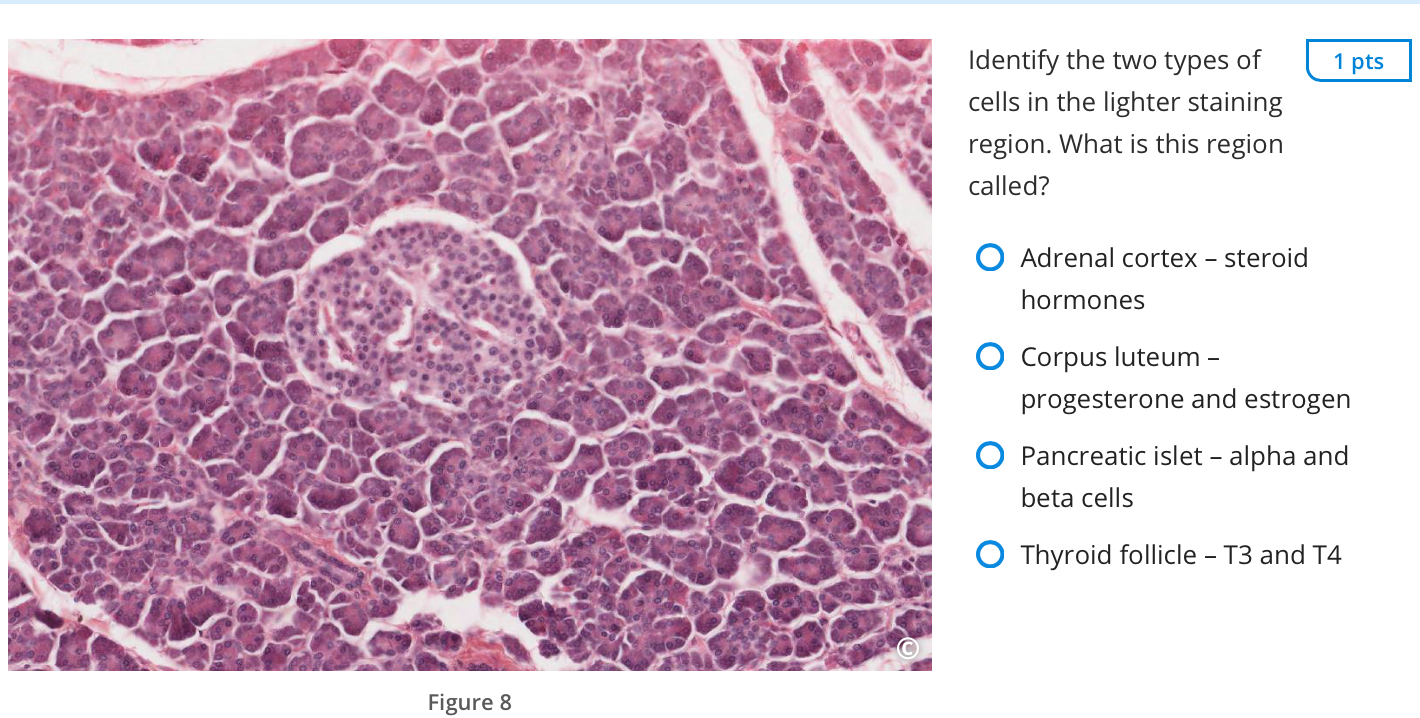 Solved 1 pts Identify the location of the endocrine tissue | Chegg.com
