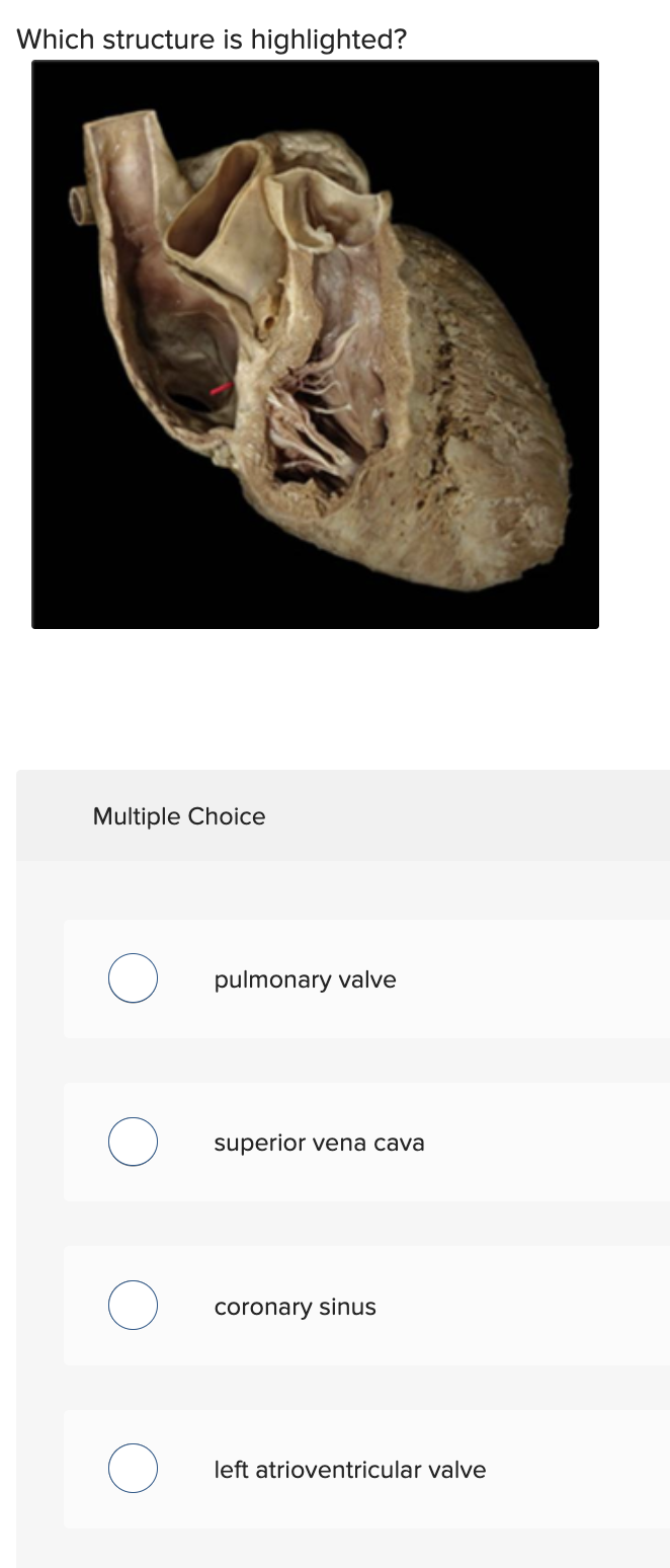 Solved Which structure is highlighted? Multiple Choice | Chegg.com