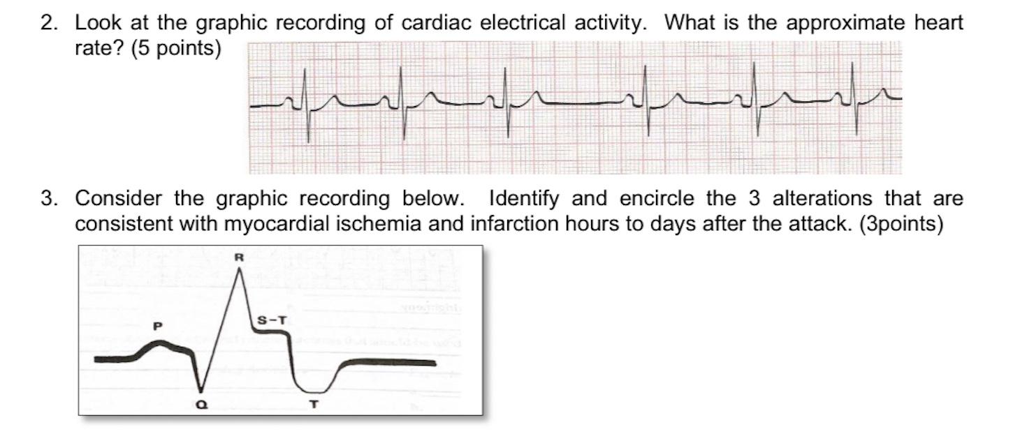 Solved 2. Look at the graphic recording of cardiac | Chegg.com