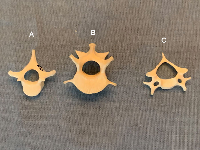 Solved Compare the three vertebrae in the picture below from | Chegg.com