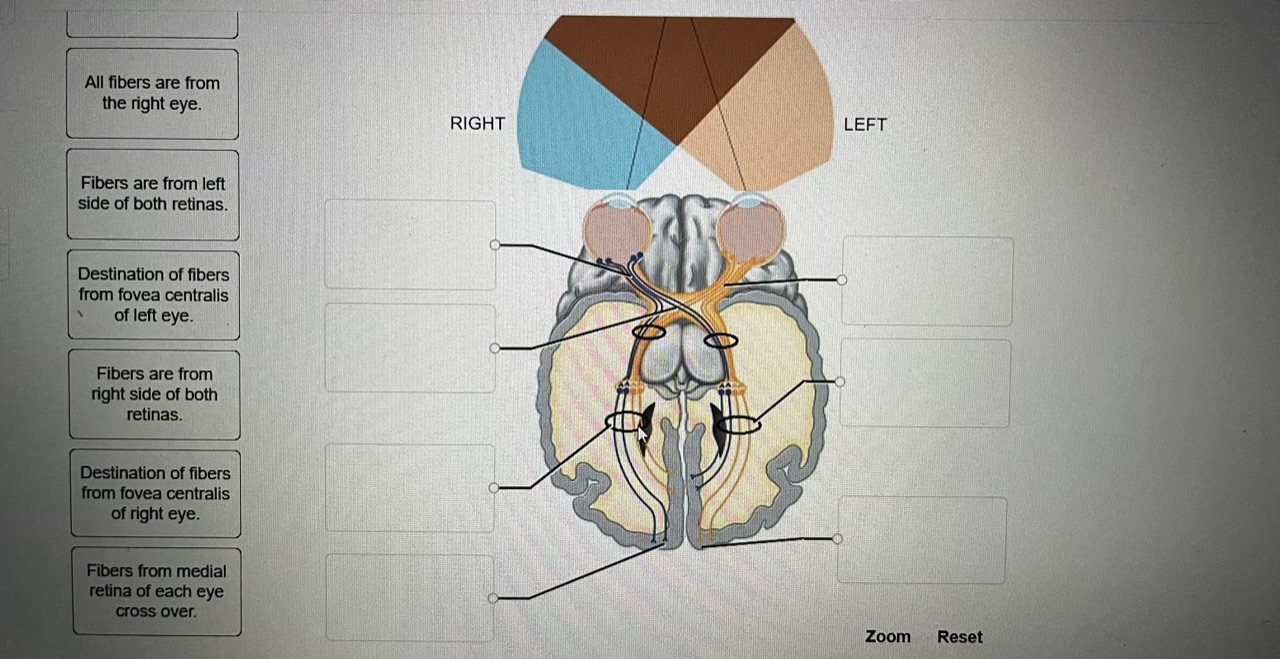 Solved Visual Pathways and Visual Deficits: Fibers within | Chegg.com