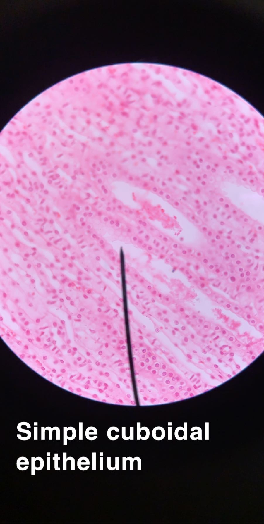 Solved Tissue name; Simple cuboidal epithelium Label the | Chegg.com