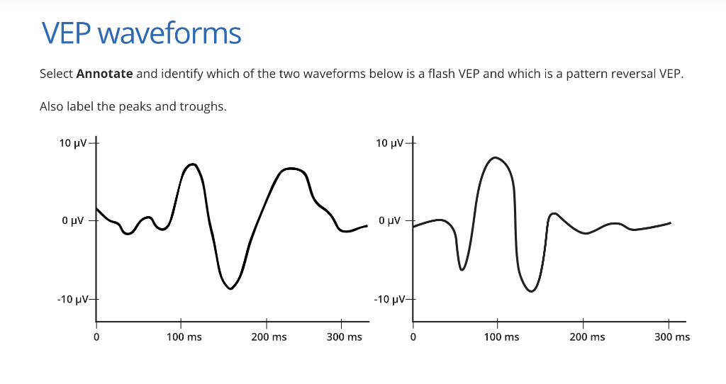 Solved VEP waveforms Select Annotate and identify which of | Chegg.com