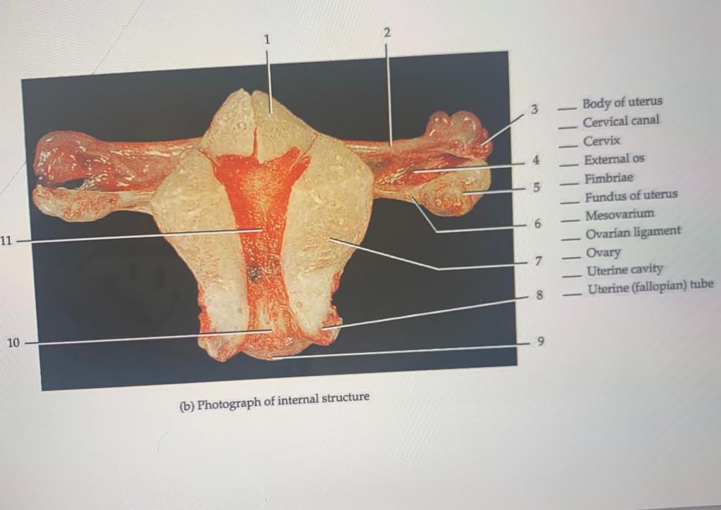 Solved 3 4 5 Body of uterus Cervical canal Cervix External | Chegg.com